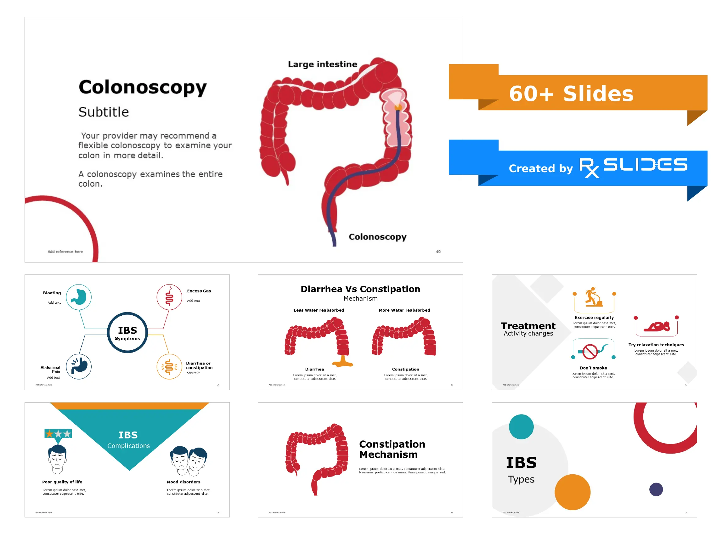 Download Irritable bowel syndrome (IBS) PowerPoint Template| RxSlides